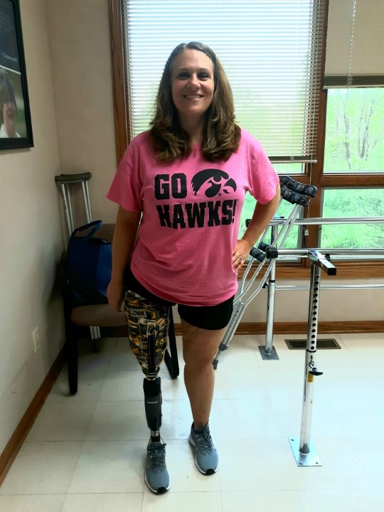 Prosthetics | Prosthetics & Orthotics | CPO - Best quality US