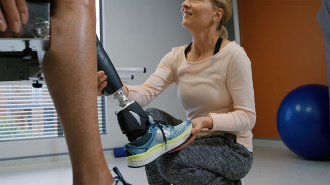 Lower Extremity Prosthetics | CPO USA | Midwest Provider