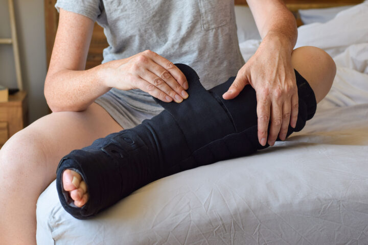 Compression Therapy - Comprehensive Prosthetics & Orthotics